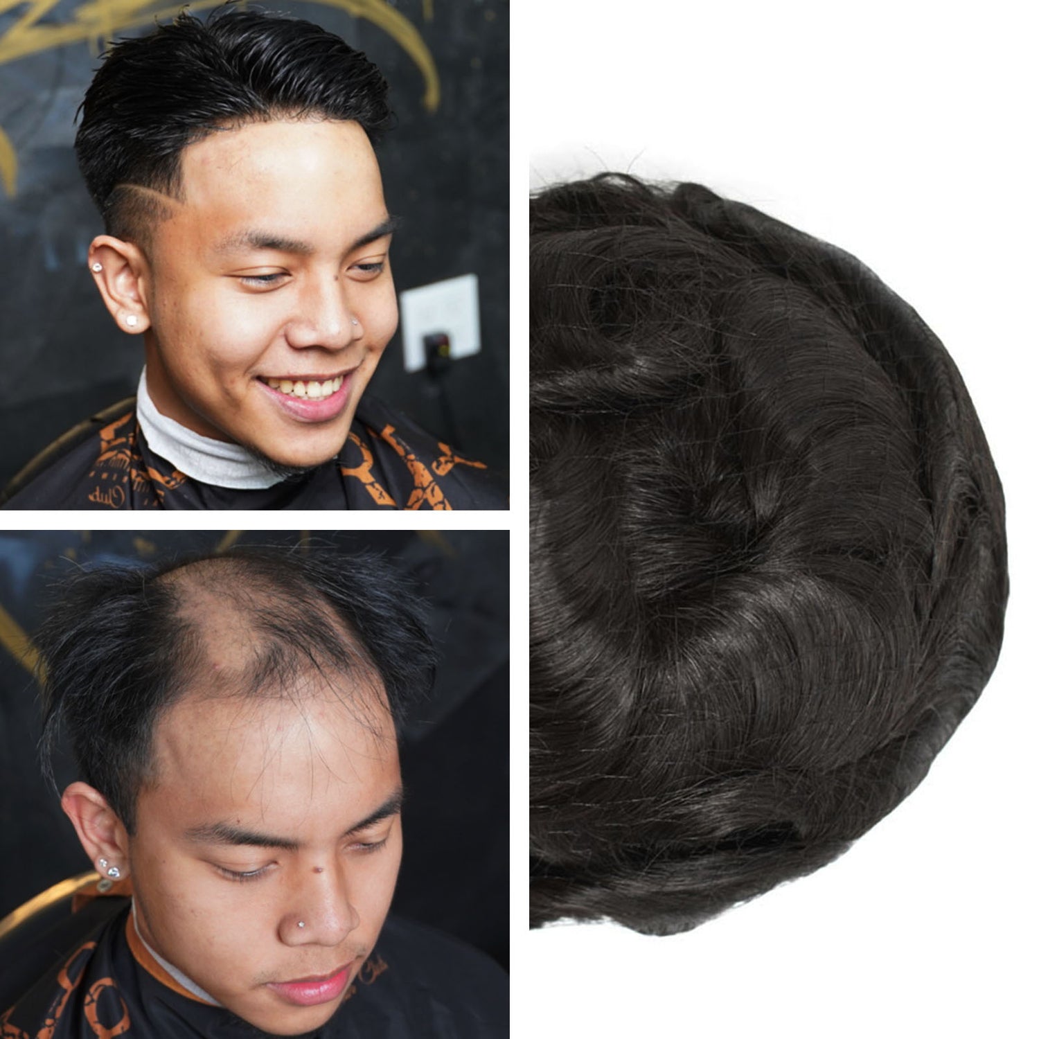 Collections – Hair Replacement Crown, LLC